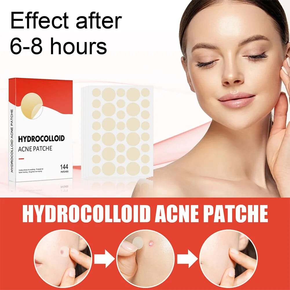 Acne Cover Patches, Hydrocolloid Acne Pimple Patches, Day and Night Zi ...