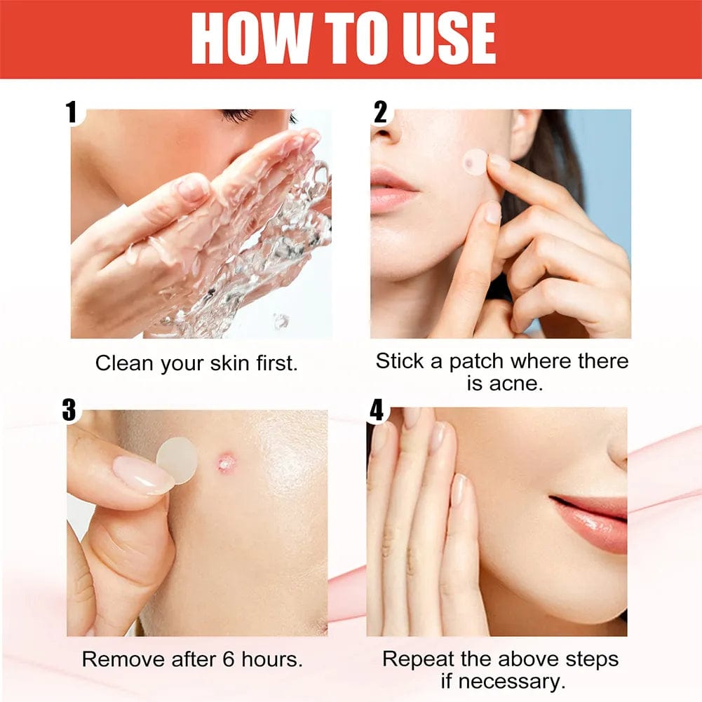 Acne Cover Patches, Hydrocolloid Acne Pimple Patches, Day and Night Zi ...